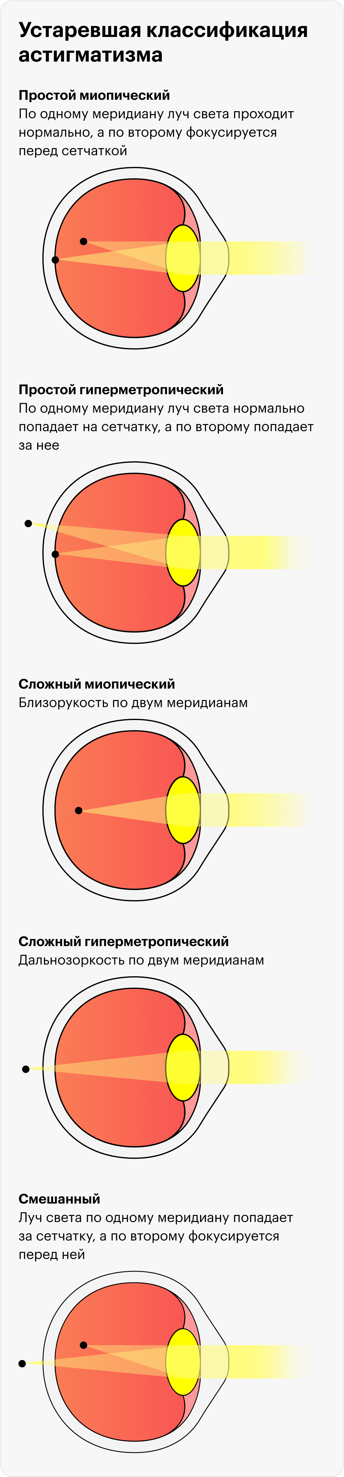 Астигматизм и дальнозоркость у детей